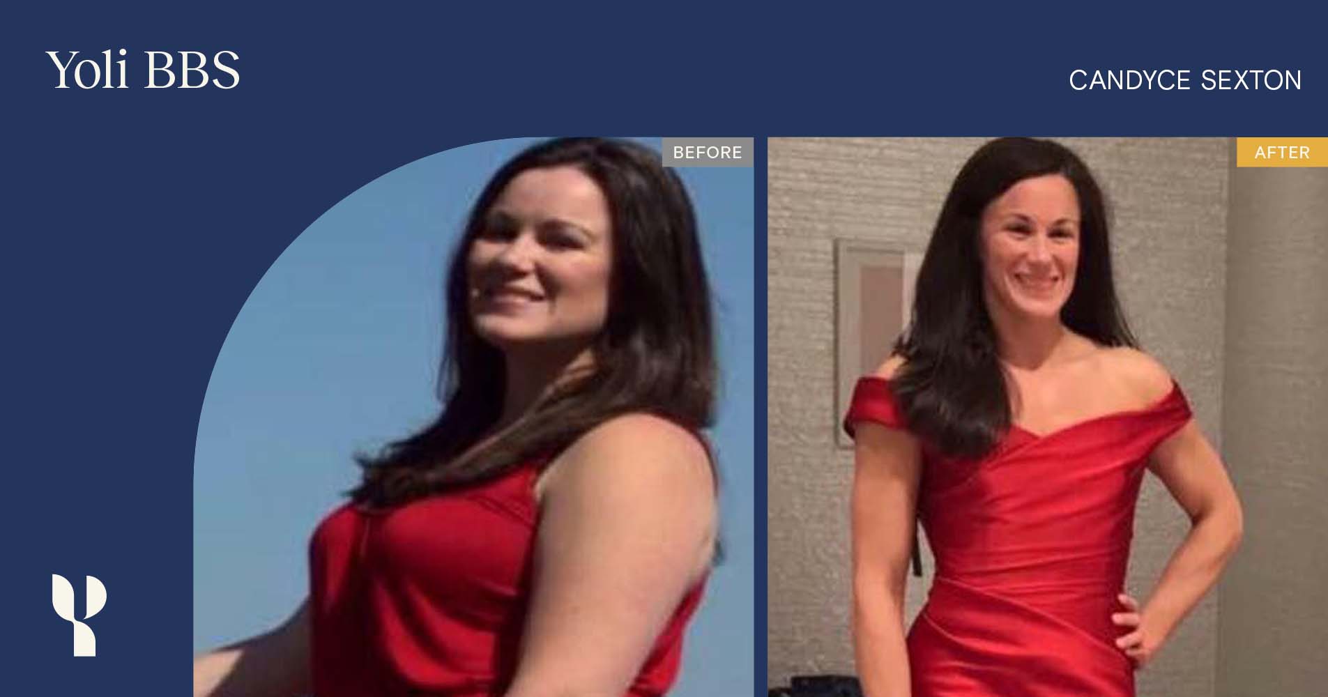 Candyce sexton_Before-After_Template_1200x630_1-3 | Yoli.life